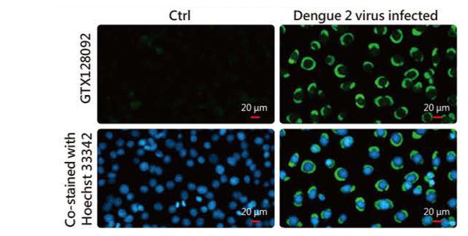 GeneTex antibodies for virus research (100ul, 25 ul)